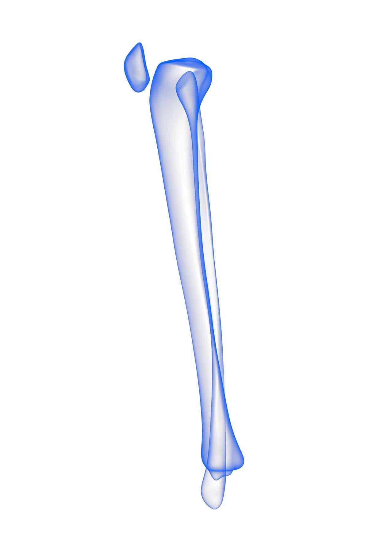 High Tibial Osteotomy | HTO | Mr Sam Nahas