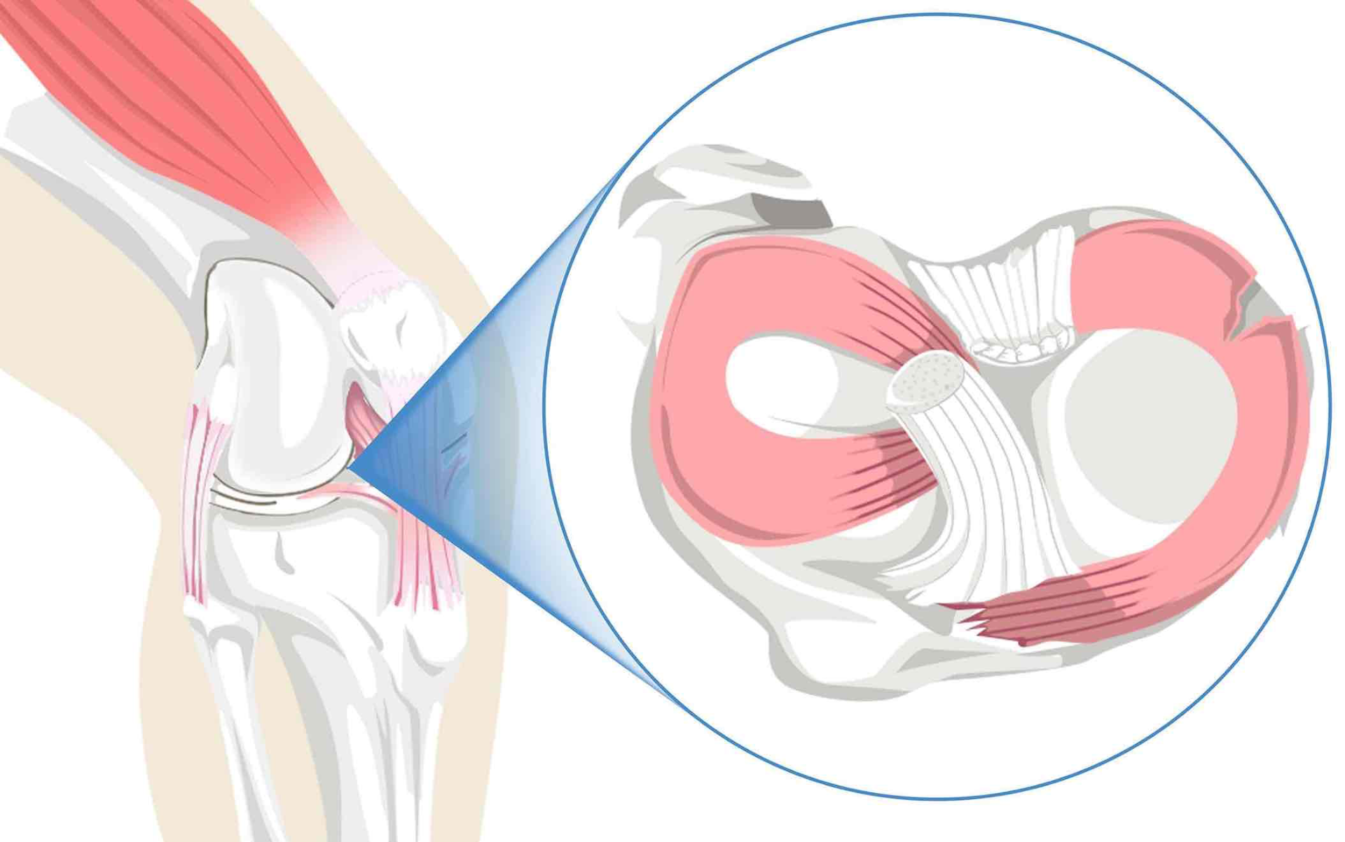 Knee Surgeon Reading | Mr Sam Nahas | Same-Week